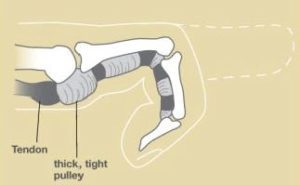 WRIST JOINT - Samarpan Physiotherapy Clinic