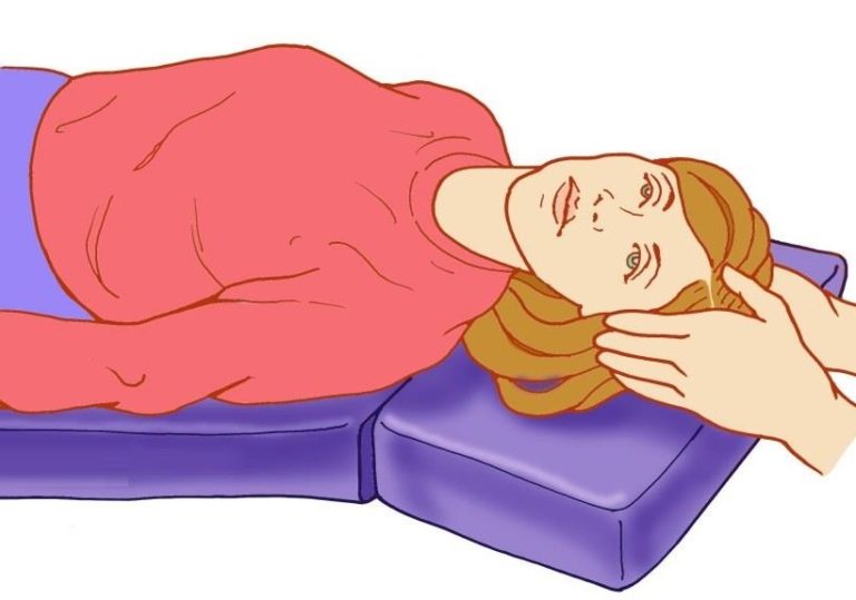 Vertigo And Physiotherapy Treatment and Exercise Detail