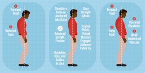 Physiotherapy exercises for the Scoliosis - Samarpan PhysiO