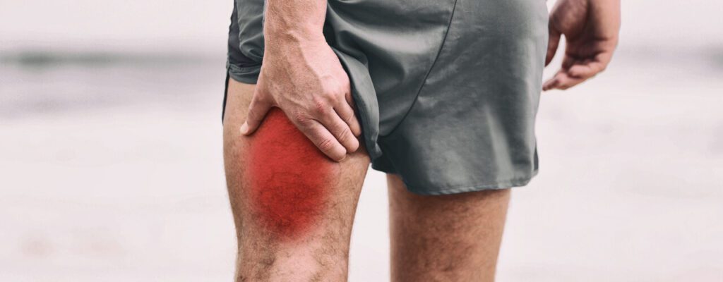 Quadriceps muscle strain: Cause, Symptoms, Treatment, Exercise