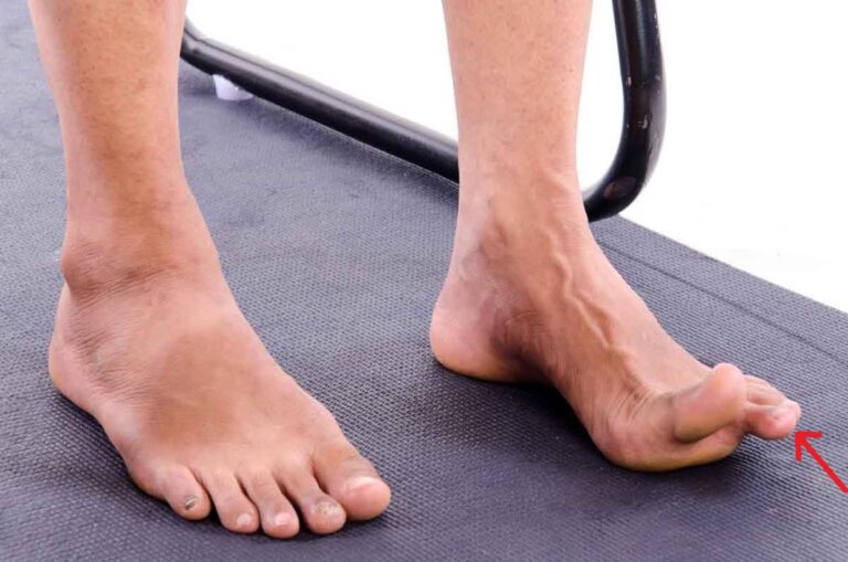 Ankle Range of motion exercise: Active, Active assisted, Passive exercise