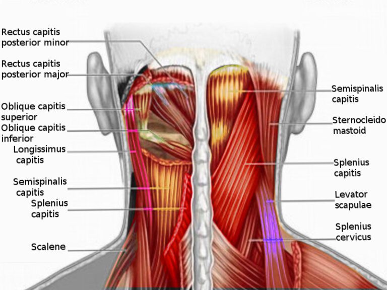 Neck muscle strain - Cause, Symptoms, Treatment, Exercise