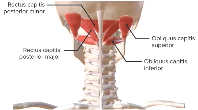rectus capitis posterior minor stretch Archives - SAMARPAN ...