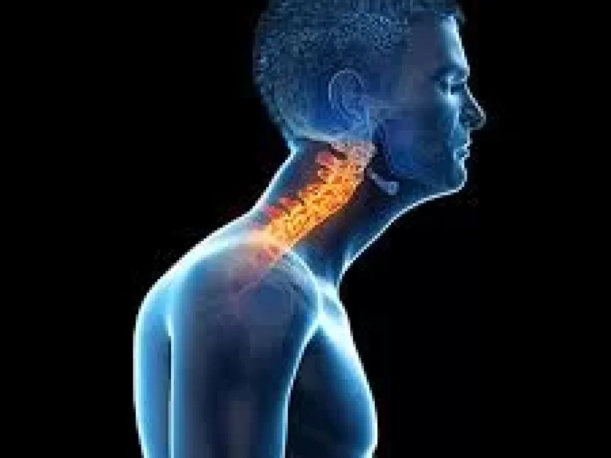 Neck Pain Forward Head Posture Xi Neck Range Of Movement