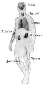Systemic Disease - Examples, Symptoms, Treatment