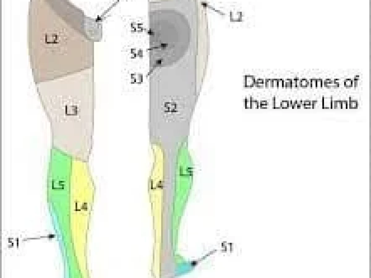 Lower Extremity Dermatomes Foot Lower Extremity Dermatomes Foot