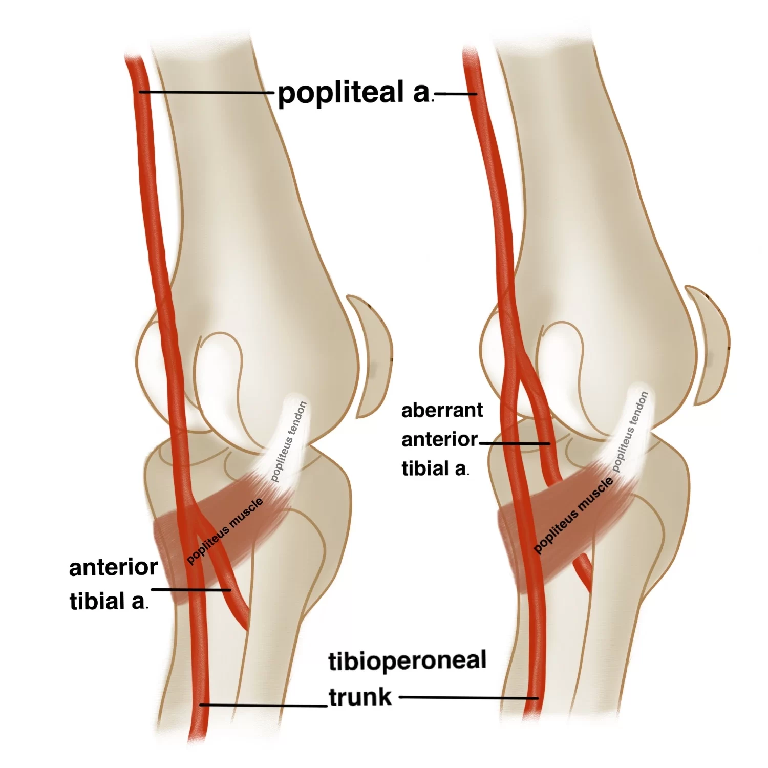 Anterior Tibial Arterie Modell